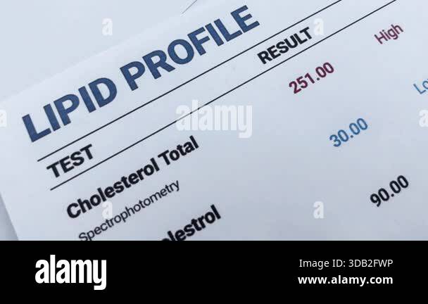 Lipid profile for checking cholestrol through medical process, 4k ...