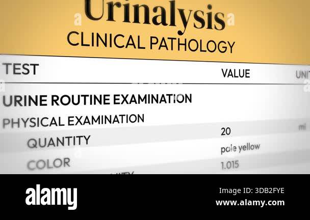 Urinalysis test report close up with text and result details, 4k ...
