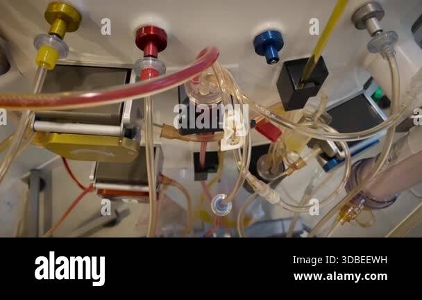 Overview Vascular Access Manifold With Colored Ports, Phlebotomist ...