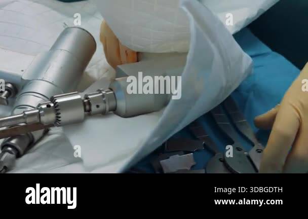 Surgeon's gloved hands preparing metal prosthetic components on a ...