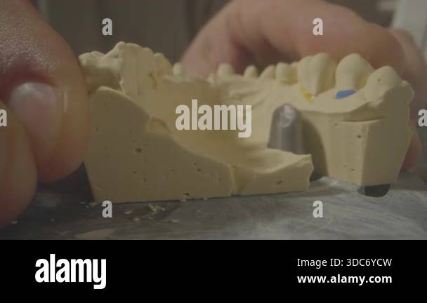 Closeup dental cast inspection on workbench with technician hands ...