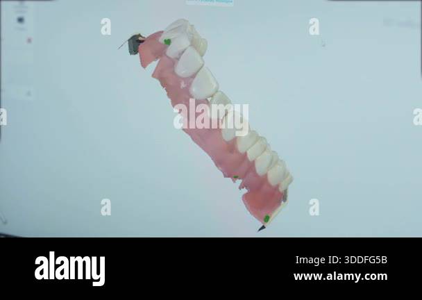 NEW YORK - February 19, 2020: Rotating dental model of artificial teeth ...