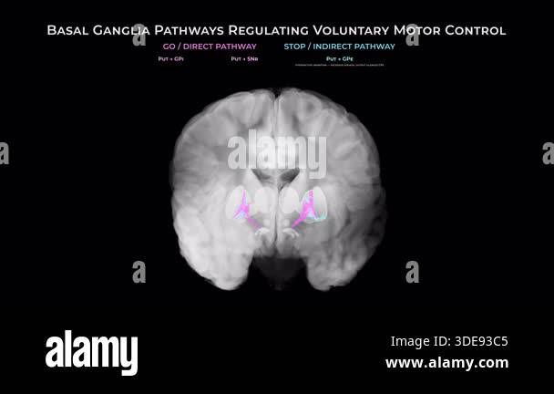 Healthy basal ganglia pathways displayed in a coronal brain view over a ...