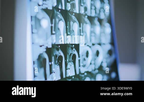 Detailed x-ray display showing human skeletal structure closeup view ...
