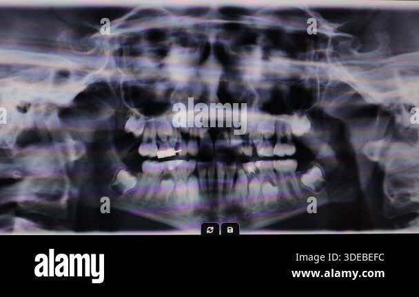 Dentist reviewing panoramic dental X-ray of a 9-year-old child, showing ...
