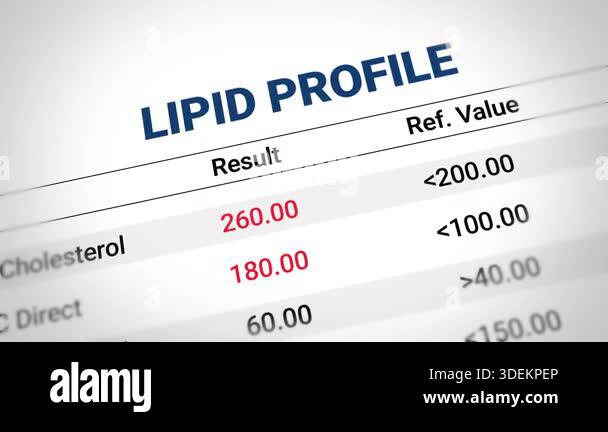 Lipid Profile test showing high results in red alarming color 4k ...