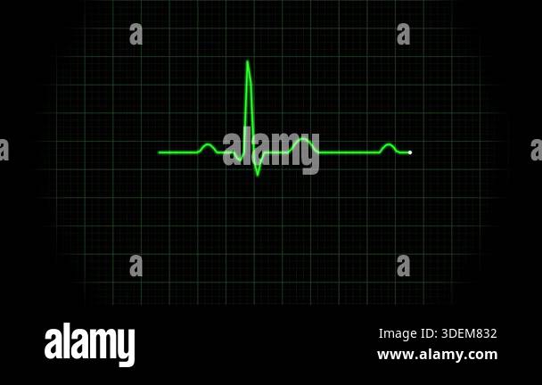 Green Digital Heartbeat Pulse Line Stock Video Footage - Alamy