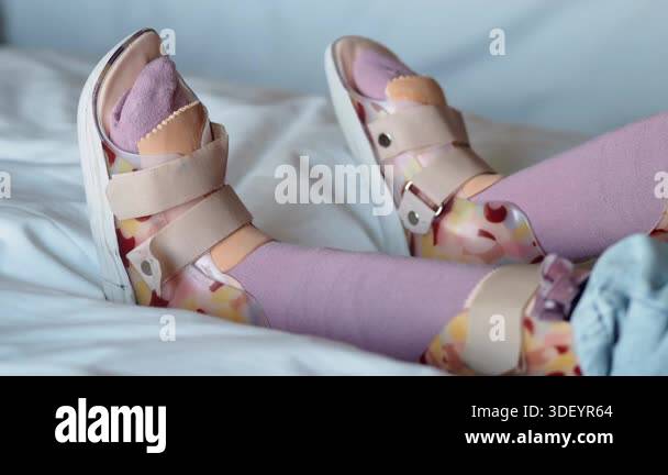 Leg braces for children with medical needs Stock Video Footage - Alamy