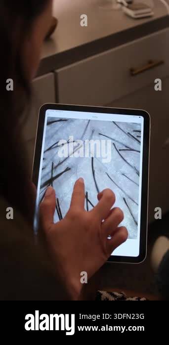 Dermatologist analyzing a microscopic image of a patients scalp and ...