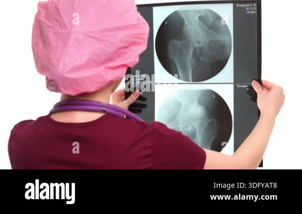 Young nurse dark brown in uniform holding x-ray - Isolated Stock Video ...