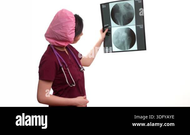 Young woman dark brown in uniform holding x-ray - Isolated Stock Video ...