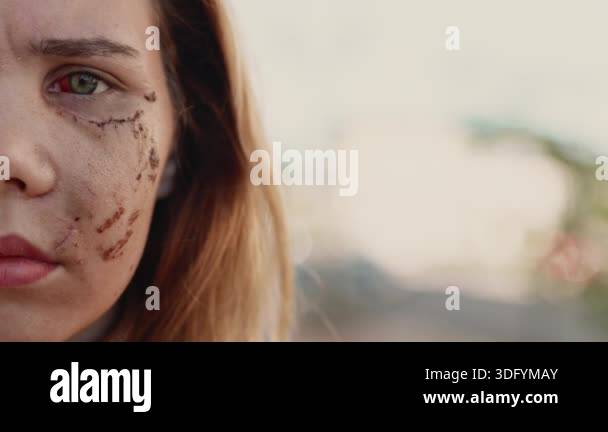 Young woman half portrait with scar on her face. Home violence victim ...