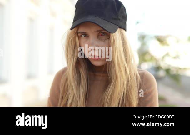 Young woman portrait with scar on her face. Home violence victim ...