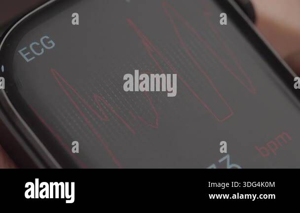Closeup of smartwatch displaying heart rate monitor graph Stock Video ...
