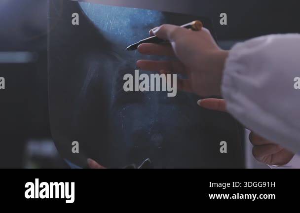 Medical staff team african american meeting discussing chest x-ray film ...