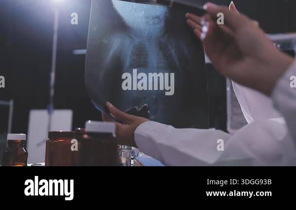 Medical staff team african american meeting discussing chest x-ray film ...