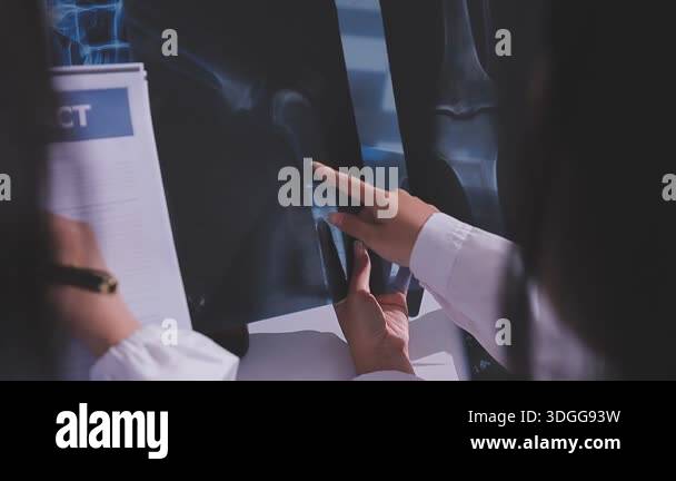 Medical staff team african american meeting discussing chest x-ray film ...