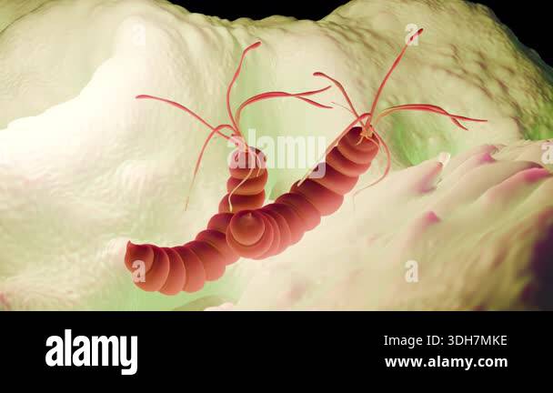 Helicobacter Pylori Bacteria - Stomach Ulcer Pathogen Visualization ...