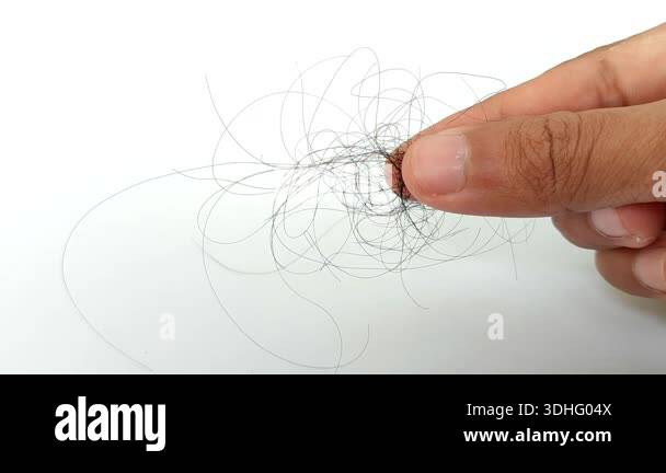 Close up hand holding fallen hair strands on white background. Concept ...