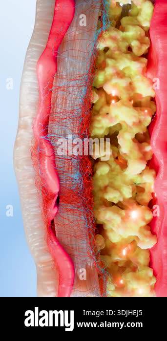belly fat burning process under the skin with realistic cross section ...
