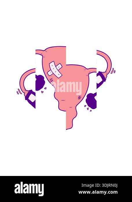 splitting motion animation of cartoon beat up uterus with boxing gloves ...