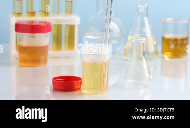 Urology. Taking urine sample from container at white table against ...