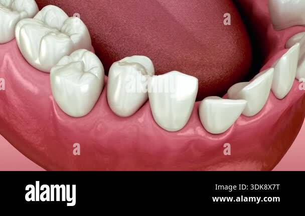 High-quality dental model showcasing white teeth and pink gums on a ...