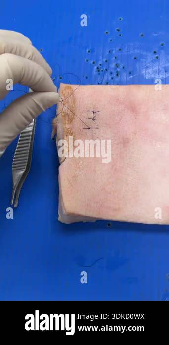Close up View of Vertical Footage of Medical Student Practicing Suture ...