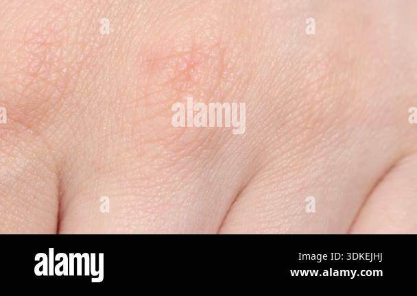 Texture of normal skin as background, closeup. Camera moving up Stock ...