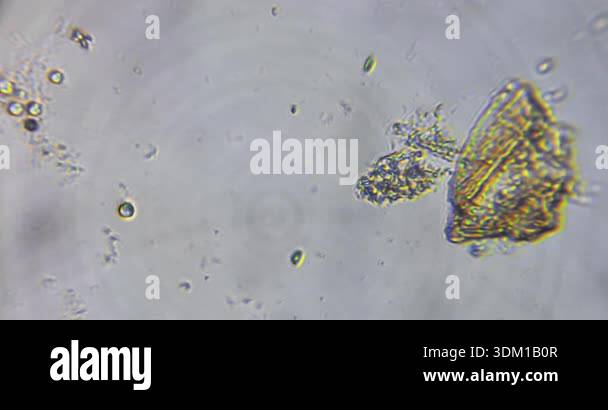 Aquatic microfauna Stock Videos & Footage - HD and 4K Video Clips - Alamy
