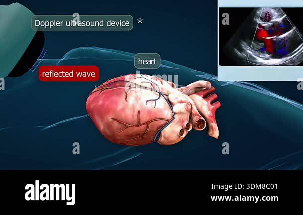 3d animation of heart ultrasound with Doppler device showing blood flow ...