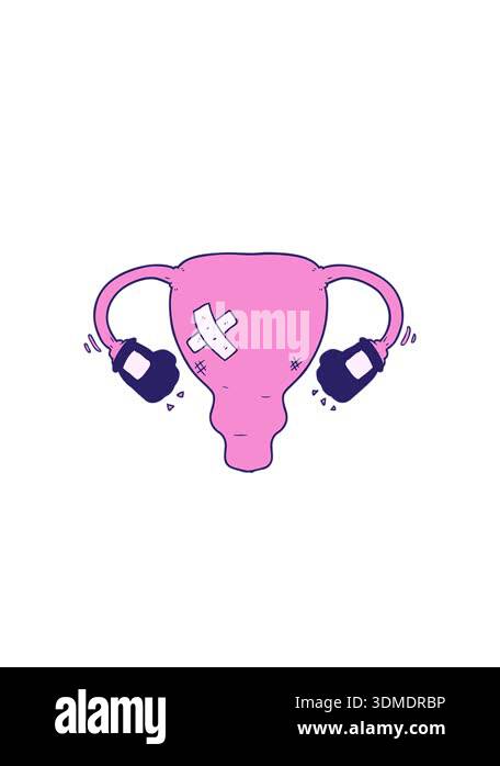 blinking radial lines animation of cartoon beat up uterus with boxing ...