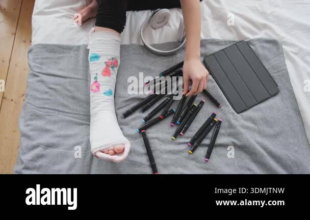 Young teenage girl with broken leg sitting on bed draws with felt tip ...