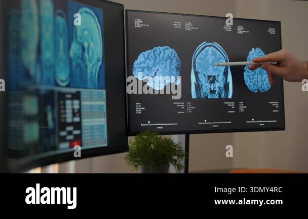 Doctor analyzing brain scan images on medical monitors, advanced ...