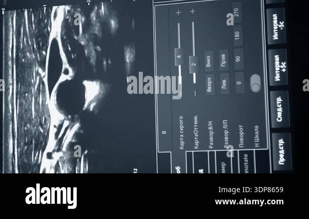 Modern patient monitor close-up. Electronic health monitor displaying ...