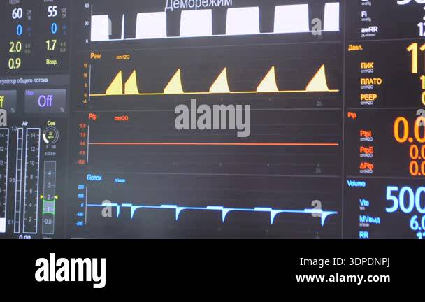 Modern patient monitor close-up. Electronic health monitor displaying ...