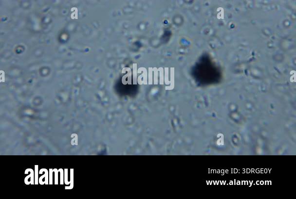 microscopic footage of live microorganisms in water showing protozoa ...
