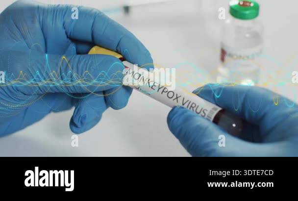Lab tech picking up yellow cap tube rotating to show MONKEYPOX label as ...