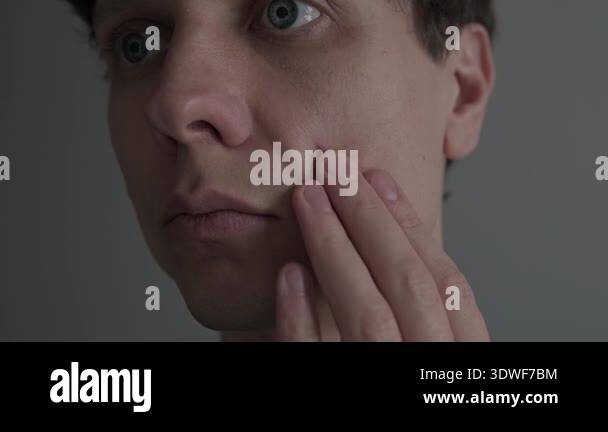 Single pimple on male face, extreme macro skin texture, acne and ...