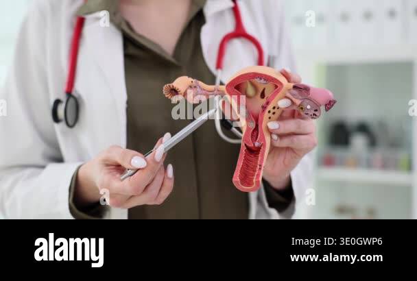 Model of the female reproductive system gynecologist holding a pen and ...