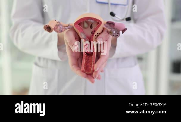 3D model of healthy uterus in hands of a gynecologist. Cervical ...