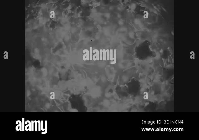 BRITAIN - 1903 - Cheese mites are viewed under a microscope Stock Video ...