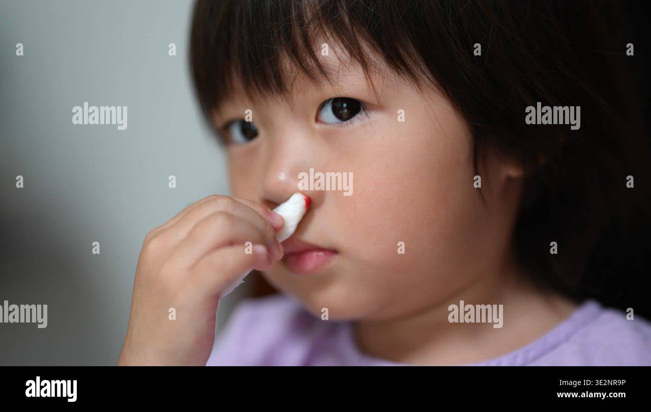Child uses tissue to stop nosebleed Stock Video Footage - Alamy