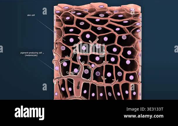 3d animation of nevus or birthmark formation showing skin cells ...