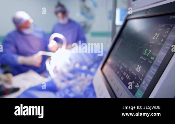 Side view on the screen of lung ventilator with life parameters. Team ...