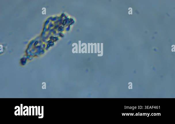 high-magnification video capturing real motion of protozoa, amoeba, and ...