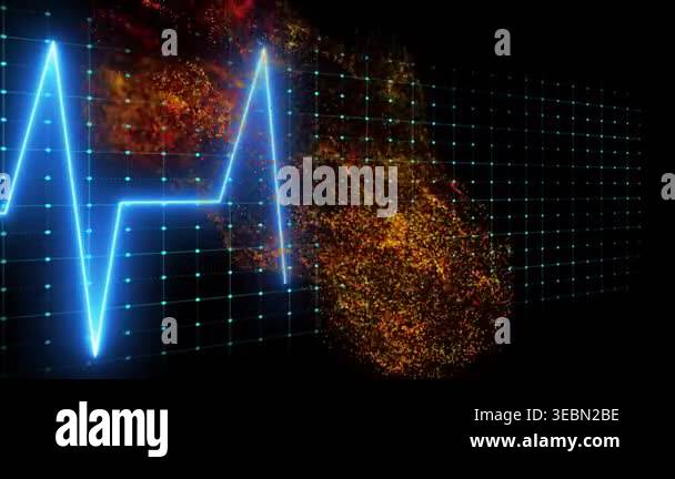 Neon cyan ECG waveform pulsing rightward after sharp spike spawning ...