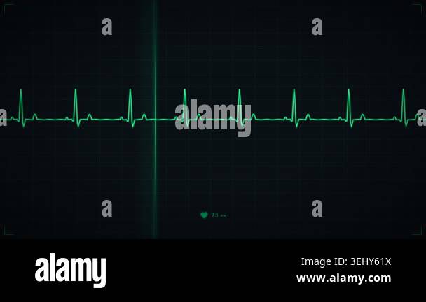 A close-up view of a digital medical heart rate monitor screen ...