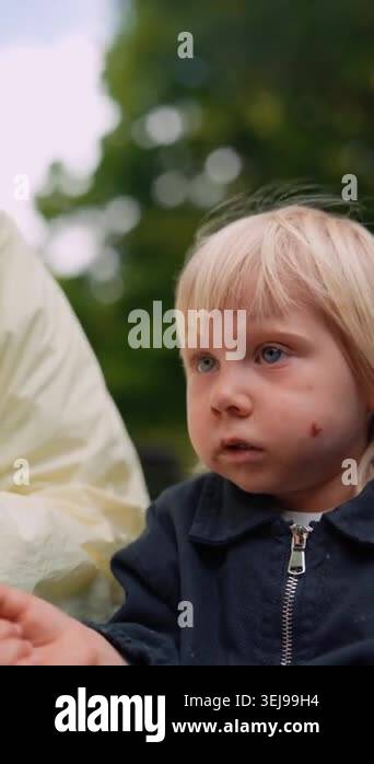 Closeup white toddler with cheek scrape and curious gaze in park, pale ...