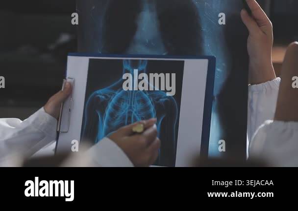 female doctor showing x ray Stock Video Footage - Alamy